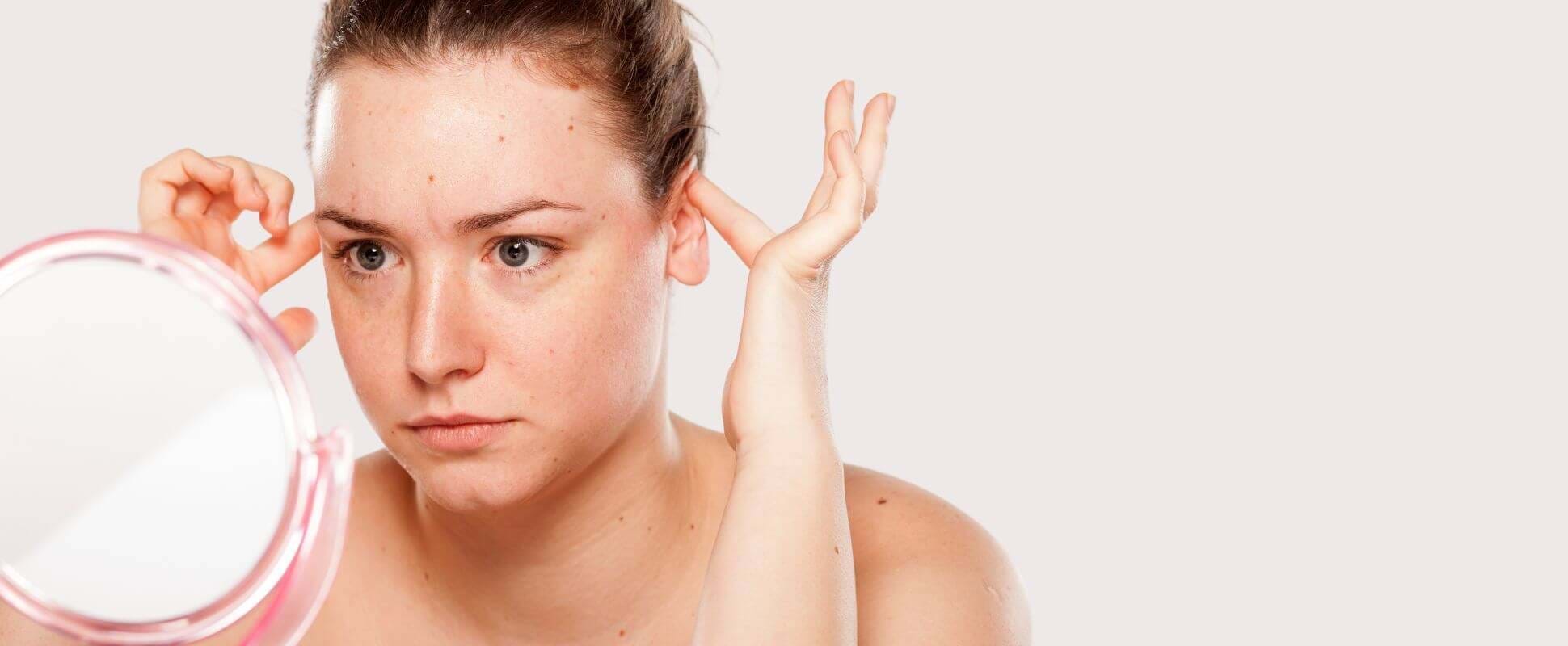 Flaporen corrigeren - Hoe werkt dat? | Wellness Kliniek